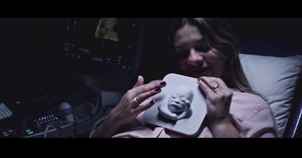 3D-Printed Ultrasound Lets Visually Impaired Mother ‘See’ Her Unborn ...